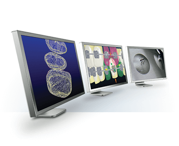 Insignia™ - Customized Digital Orthontic Bracket System