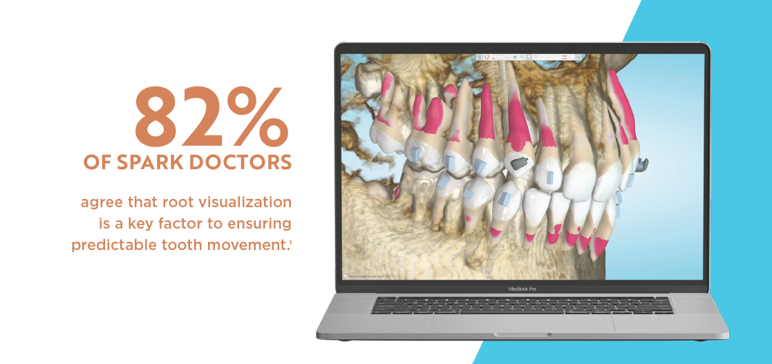 Ormco - Spark™ - Innovative & Advanced Clear Aligner System