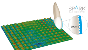 Ormco - Spark™ - Innovative & Advanced Clear Aligner System