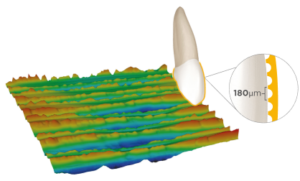 Ormco - Spark™ - Innovative & Advanced Clear Aligner System