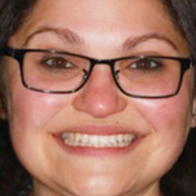 Ormco - Spark™ - Innovative & Advanced Clear Aligner System